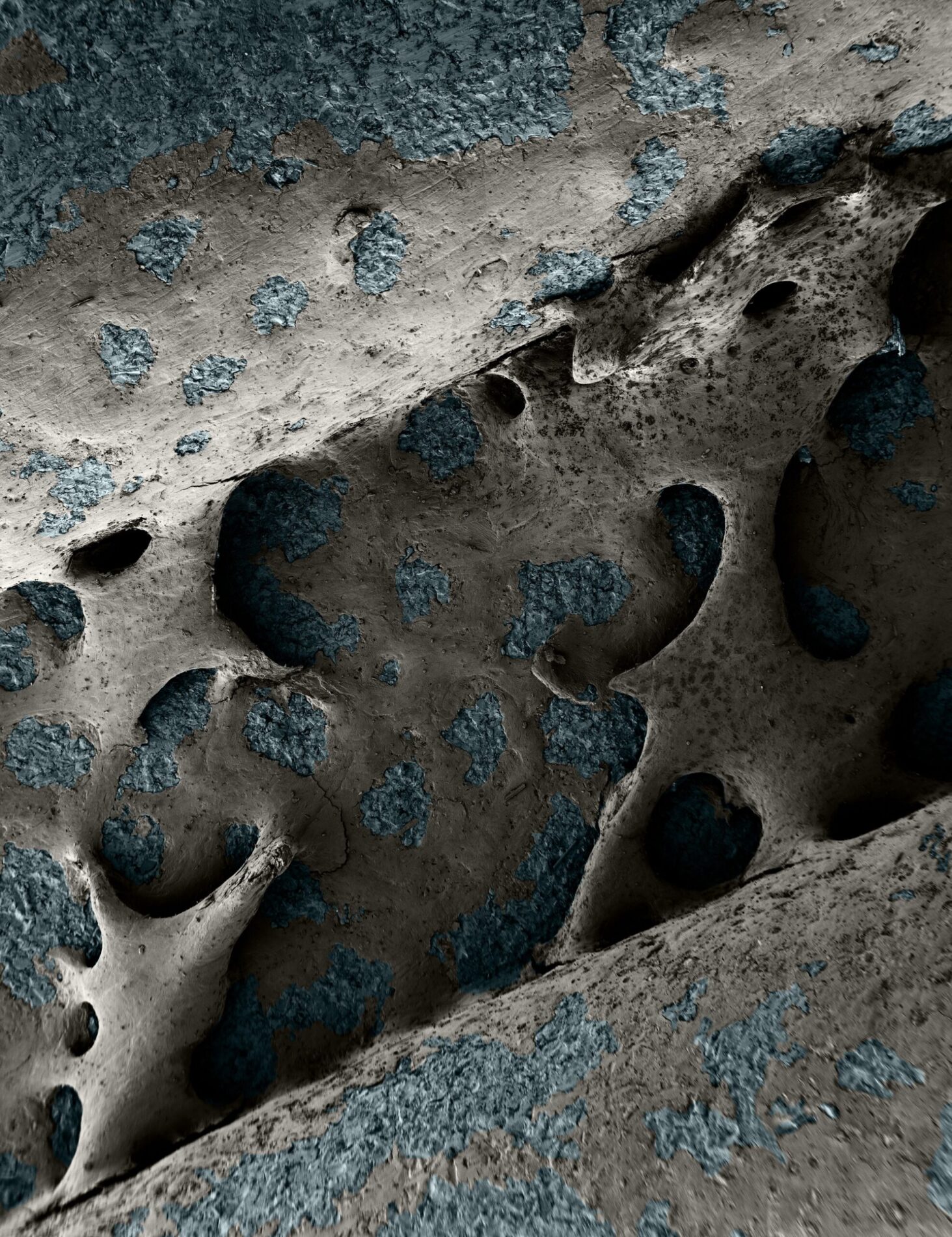 FNR Science Image Competition: Bone track - FNR