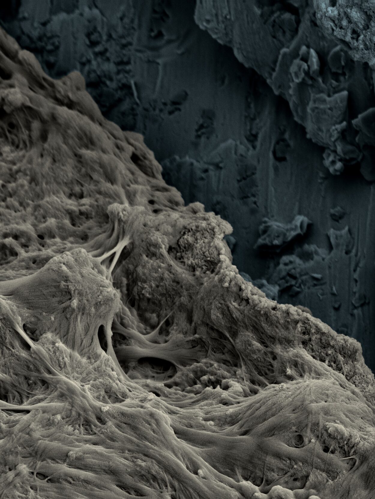 FNR Science Image Competition: Bone track - FNR