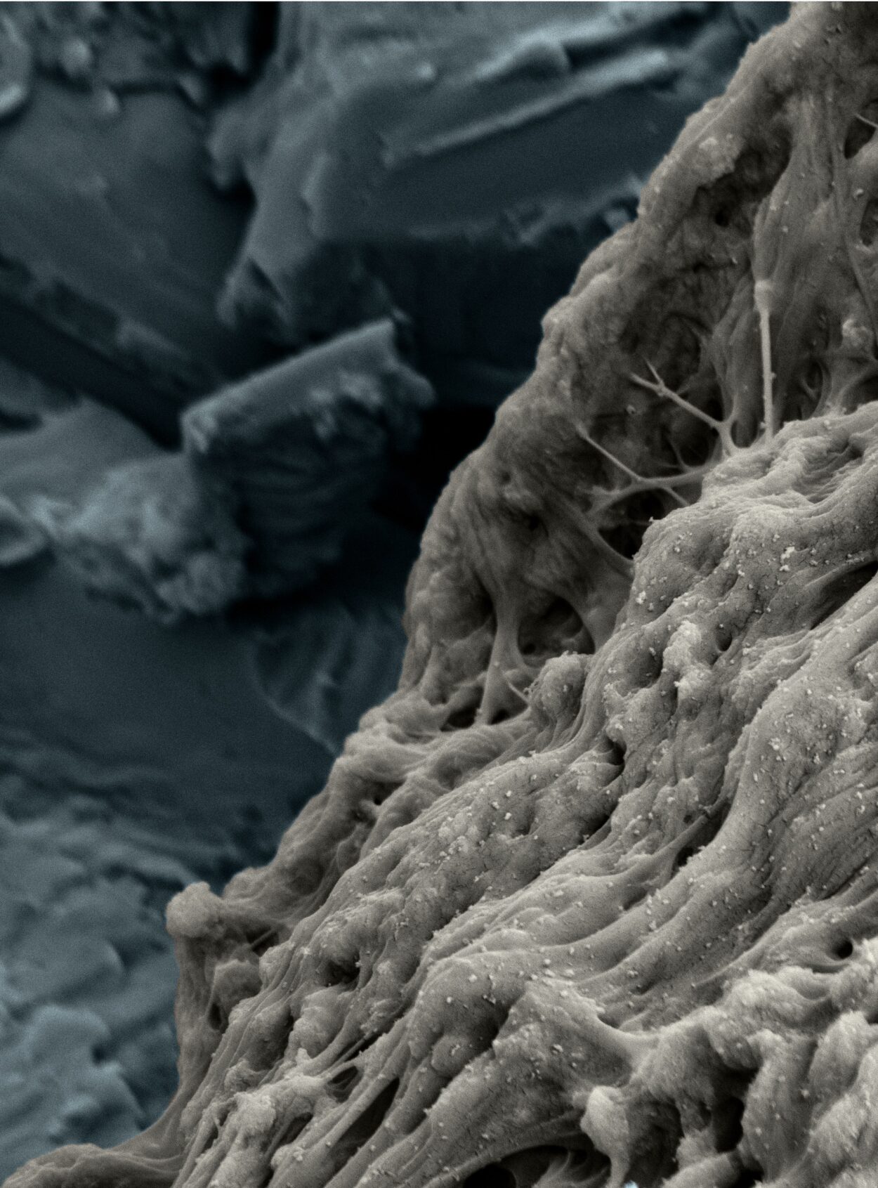 FNR Science Image Competition: Bone track - FNR