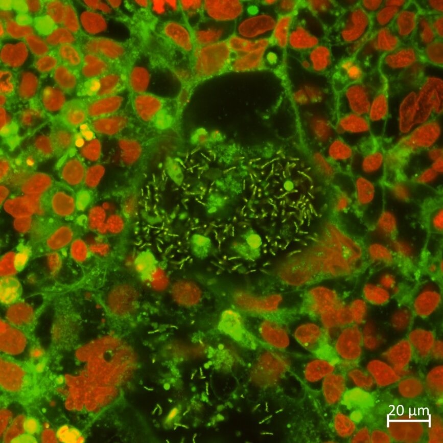 Spotlight on Young Researchers: Probiotics to the rescue - FNR